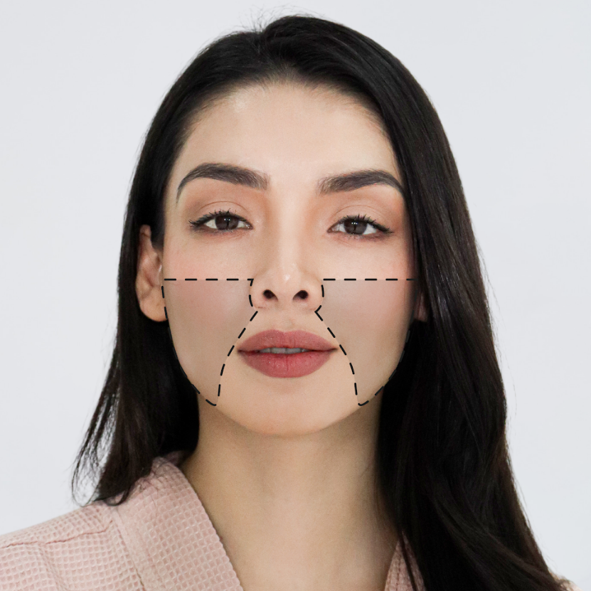 Mejillas – Depiliclinic