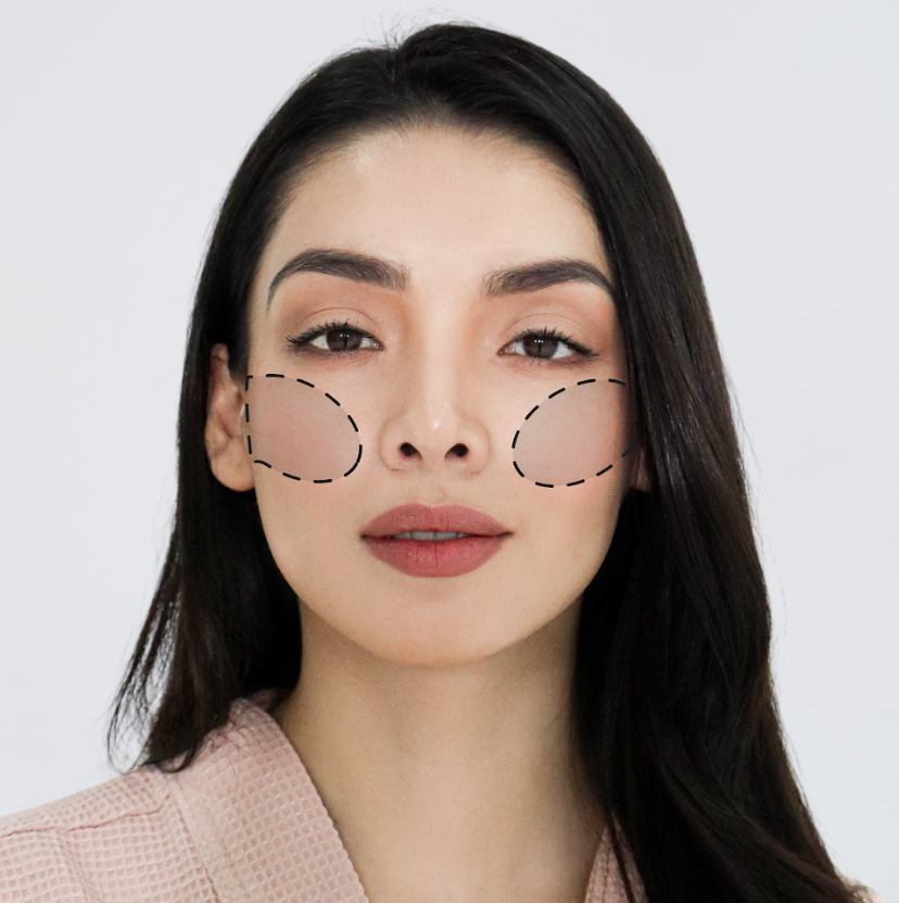 Pómulos – Depiliclinic